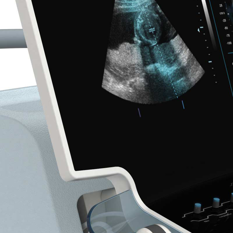 Ultrasound device - CORPUSDESIGN