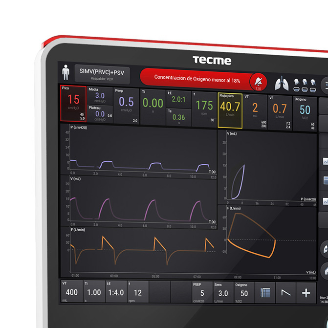 UI ventilator - CORPUSDESIGN